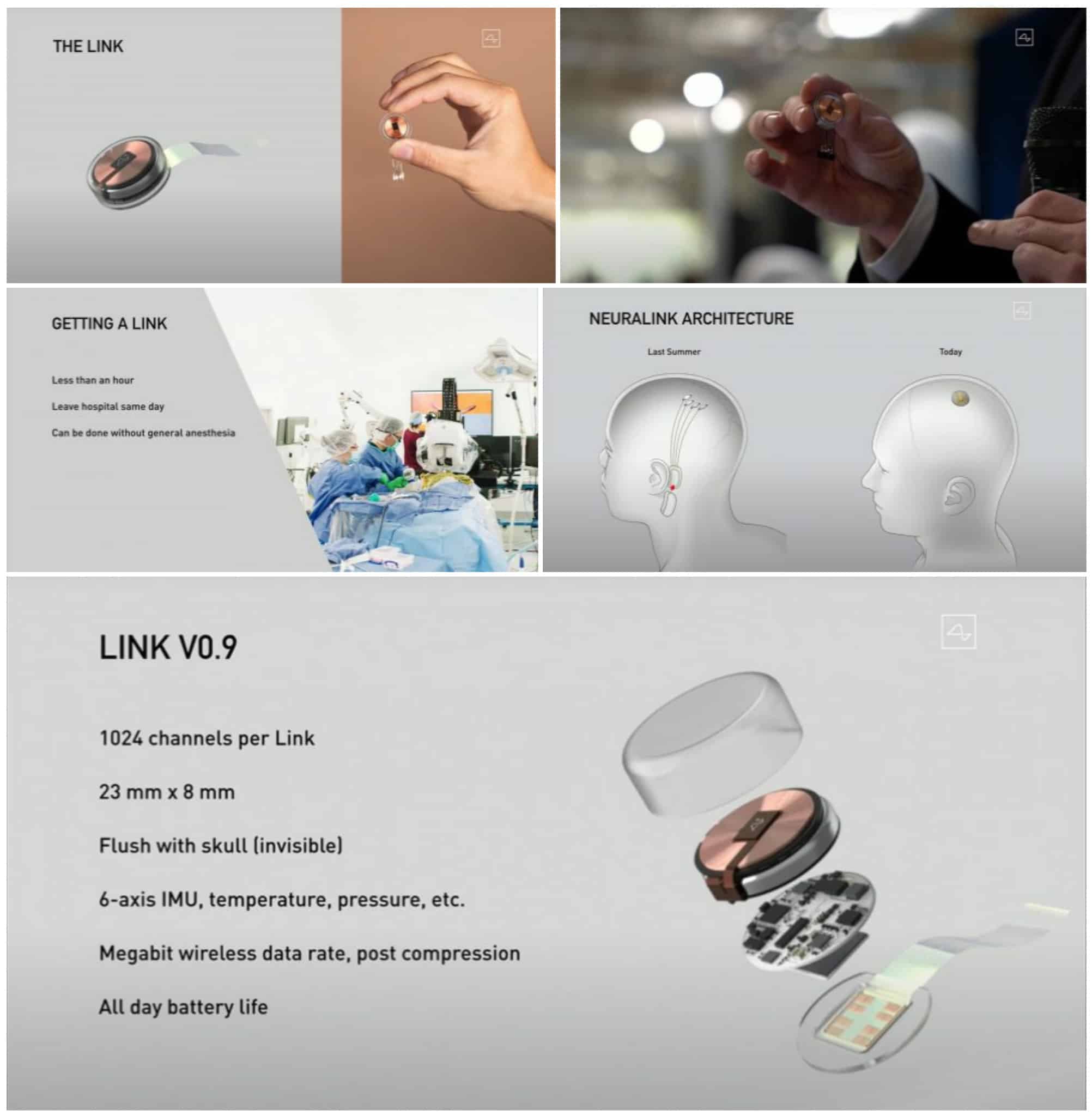 Elon Musk’s Neuralink unveils sleek V0.9 device, ‘V2’ implant robot ...