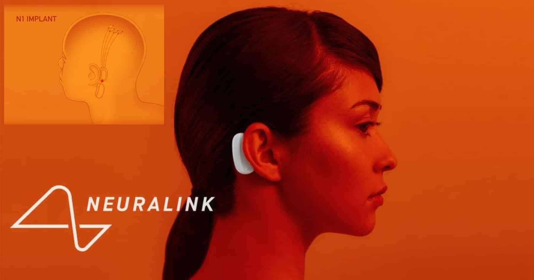What to expect during Neuralink's Demo Friday, August 28th – ilovetesla.com